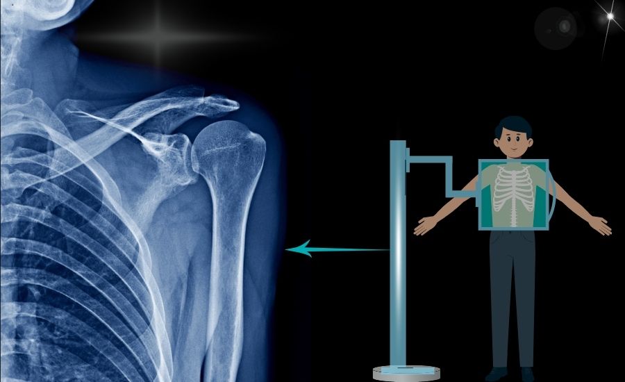 AI X-Ray Clothes The Intersection of Technology, Privacy, and Healthcare